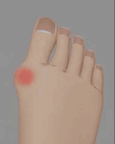 CALCETINES SEPARADORES - SOCK RELAX TOES™ – brehos.com - Tienda de ...